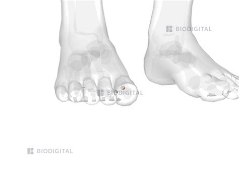 Sesamoid Bones Of Right Foot Biodigital Anatomy