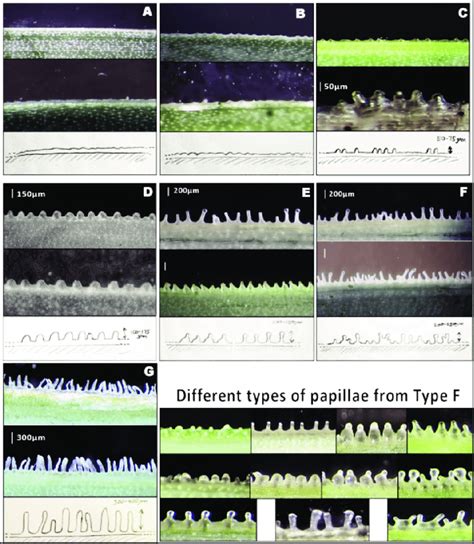 Different Types Of Leaf Margins Based On The Presence And Type Of