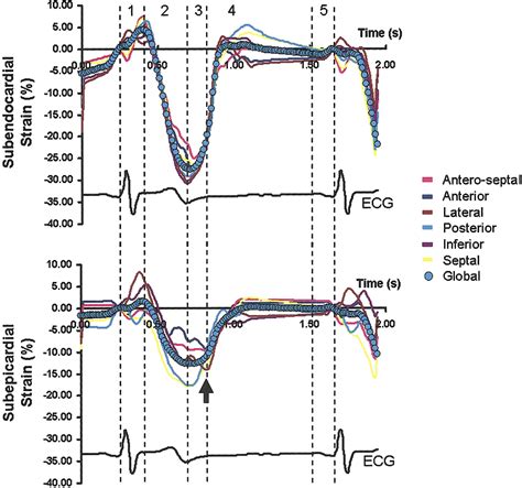 Left Ventricular Structure And Function Basic Science For Cardiac Imaging Journal Of The