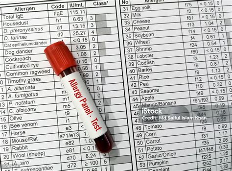 Blood Sample Isolated With Report For Allergy Panel Test Allegry