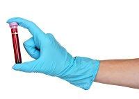 Cured Of Hepatitis C Is There Potential To Infect Others Hepatitis Central