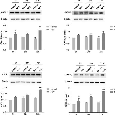 Cxcl1 And Cxcr2 Expression Is Upregulated In The Intestine A And