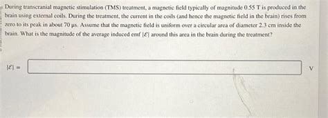 Solved During Transcranial Magnetic Stimulation TMS Chegg