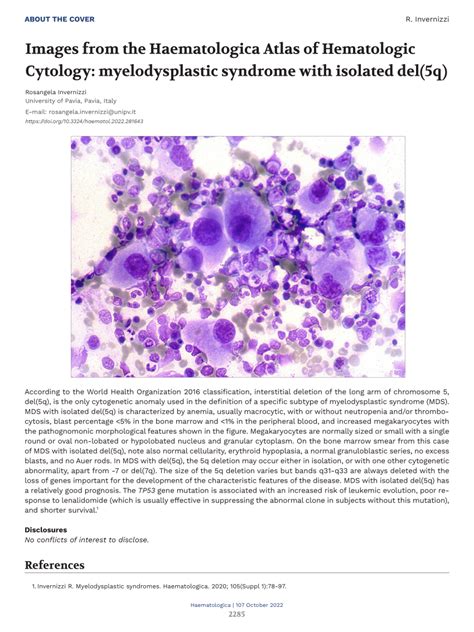 Pdf Images From The Haematologica Atlas Of Hematologic Cytology Myelodysplastic Syndrome With