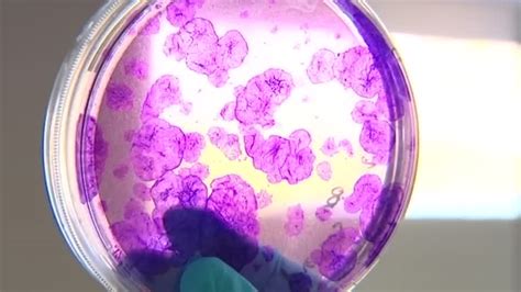 Stem Cells Transformed Into Epidermis Mediaclip