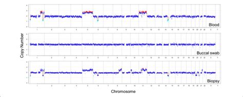Cnv Analysis Of The Patients Autosomes And Sex Chromosomes Both