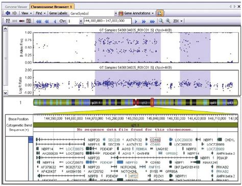 Human 660w‐quad Snp Array Results Of 1q211 Duplication In The Proband