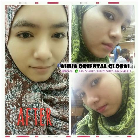 Ahha Top Up Tempek Tebal Tebal