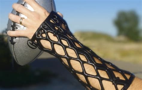 Amphibianskin Offers An Affordable 3d Printed Splint To Help The