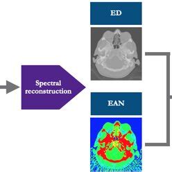 Principle Of Duallayer Spectral Ct Dlct Based Stopping Power Ratio