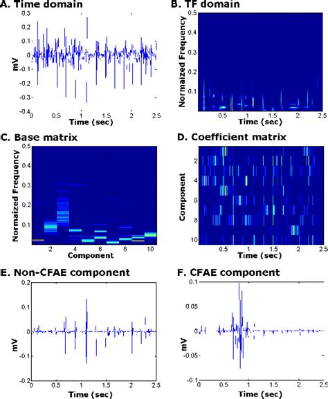 Figure 3 From Characterization Of Fractionated Electrograms Using A Novel Time Frequency Based