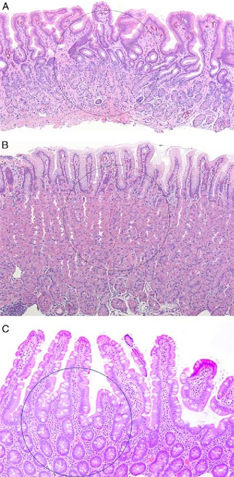 Ideally Oriented Specimens From Gastric Antrum A Body B And