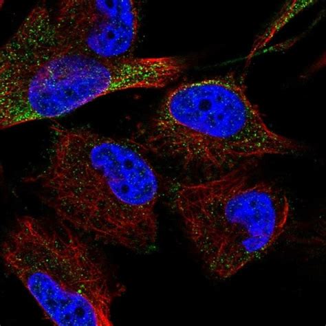 Rabbit Polyclonal Anti Adam17 Antibody Buy For Research Highly Specific Rigorously