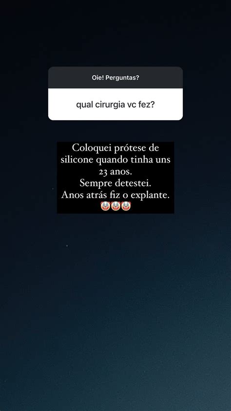 Esposa de Junior Lima Mônica Benini diz ter se arrependido de plástica Detestei