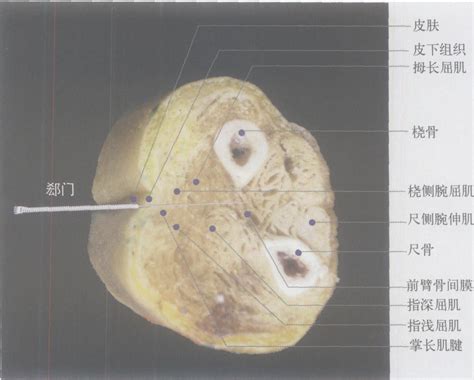 图10 4右郄门穴矢状切面 人体腧穴全真解剖 医学