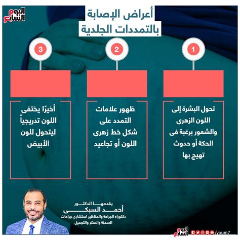 اعرف أسباب وعلاج التمددات التشققات الجلدية مع مركز الدكتور أحمد