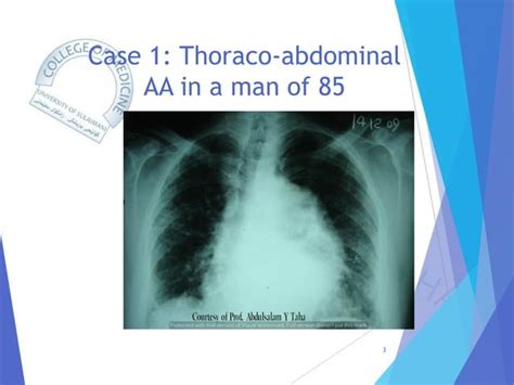 Radiology Of Thoracic Aortic Aneurysms Pdf