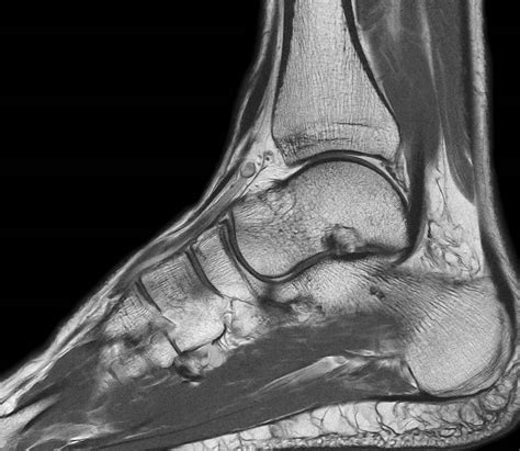 Msk Mri Anatomy