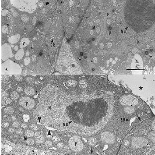 Cortical Cells From Control Root Tips A The Cell Corners Lack Download Scientific Diagram