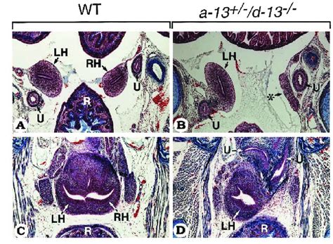 Partial Agenesis Of The Developing Uterus In A Newborn Hoxa 13 −