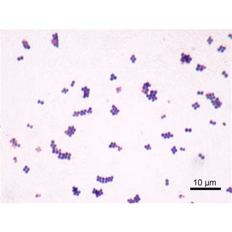 Jual Isolat Staphylococcus Aureus Kultur Stok Dalam Berbagai Pilihan