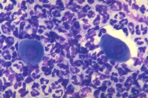 Pemphigus Foliaceus Cytology 02 In Cats Felis Vetlexicon