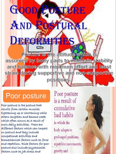 Pdf Good Posture And Postural Deformities Dokumen Tips