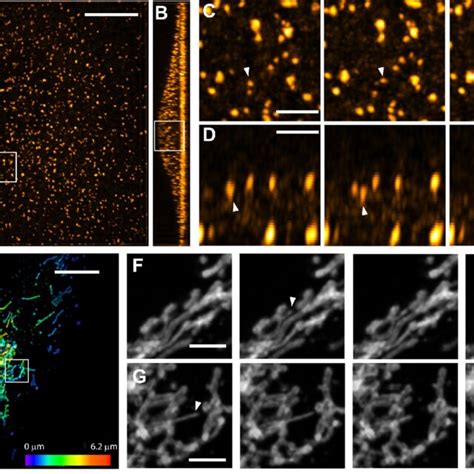 Pdf Resolution Doubling In Light Sheet Microscopy Via Oblique Plane