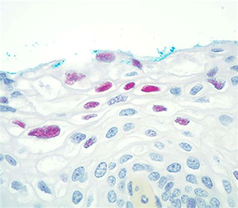 Shall You Use Biotin Or Digoxigenin For Ish Probe Labeling Enzo