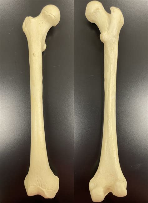 Lab Exam Ii Femur Model Diagram Quizlet