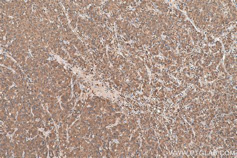 Ihceasy Gsto1 Ready To Use Ihc Kit Khc0790 Proteintech 武汉三鹰生物技术有限公司