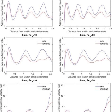 Pdfs Of Experimental Values Measured With Mri And Simulated Ibm Dns Download Scientific Pdfs Of Experimental Values Measured With Mri And Simulated Ibm Dns Download Scientific