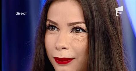 Imagini Groaznice Iuliana Luciu A Aparut La Tv Cu Fata Tumefiata