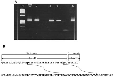 A Lanes 1 2 Flt3 Amplified In The Positive Control From One Case With Download Scientific