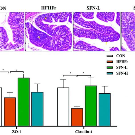 Sfn Inhibits Body Weight Gain And Alleviates Hepatic Steatosis In