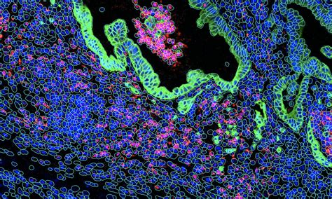 spatial multi omics from the single cell to whole transcriptome