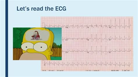 Basics Of Paediatric Ecg Pptx