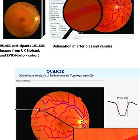 Fully Automated Retinal Image Processing Of The Vascular Tree Using