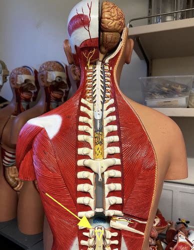 Spinal Nerves Spinal Cord Hemisection And Somatic Nerve Plexus