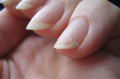 Consigli Utili Per Unghie Deboli Dopo Il Gel Adnexa It
