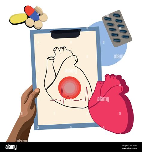 Vector Isolated Illustration Of Heart Disease Treatment Heart Disease Diagnosis