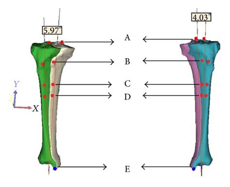 Under 3 Matic Software We Rotated The Tibia To The Standard Position Download Scientific Diagram