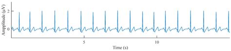 Driver Fatigue Detection Using Heart Rate Variability Features From 2