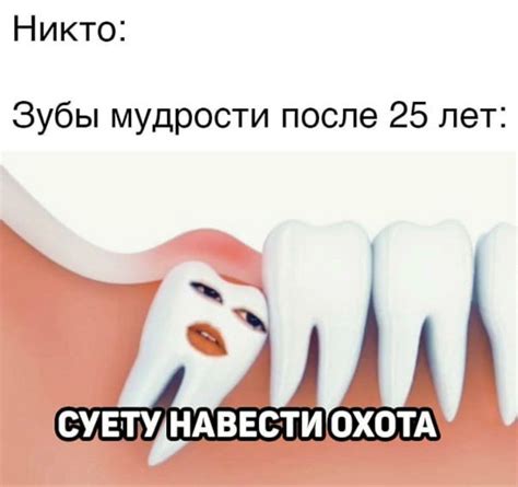 Mississauga Tooth Extraction Dental Decay Artofit