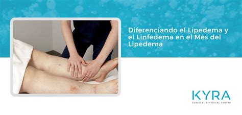 Linfedema O Lipedema Descubre Sus Diferencias Y