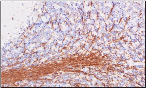 Anti Myelin Basic Protein Mbp Antibody Rp 4015
