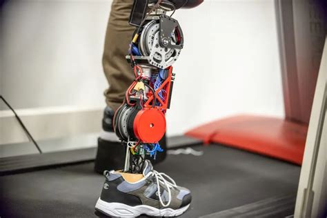 A More Comfortable Robotic Prosthetic Leg