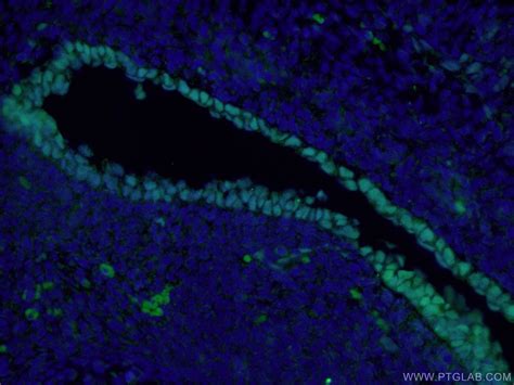 Sox2 Antibody 66411 1 Ig Proteintech