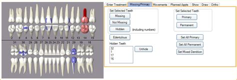 Open Dental Software Missing Primary Teeth