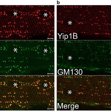 Yip1b Subcellular Localization Immunofluorescence On Single Fibers Download Scientific